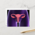 Female Reproductive Organ, X-Ray View 1 Postcard | Zazzle