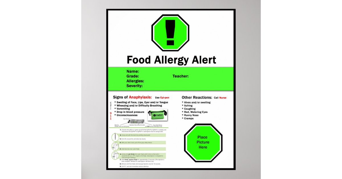 Food Allergy Poster for School | Zazzle