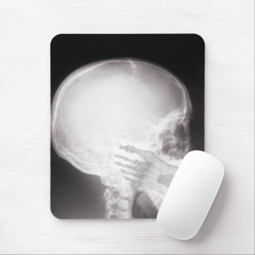 Foot in Mouth X-Ray Mouse Pad | Zazzle