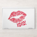 Fun Pink Lips XOXO HP Laptop Skin | Zazzle