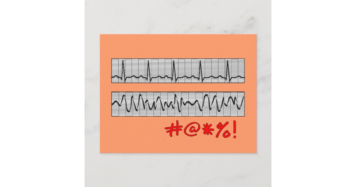 Funny Cardiac Rhythm Strip Gifts Postcard | Zazzle
