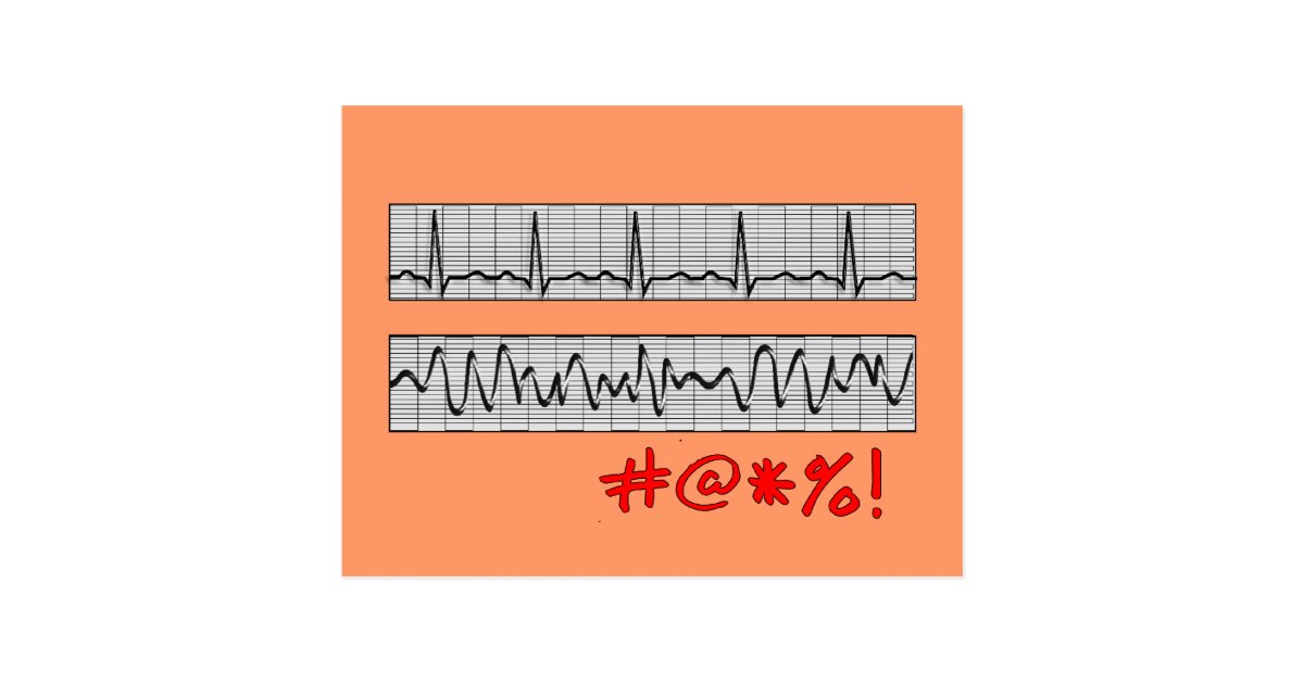 Funny Cardiac Rhythm Strip Gifts Postcard | Zazzle.com
