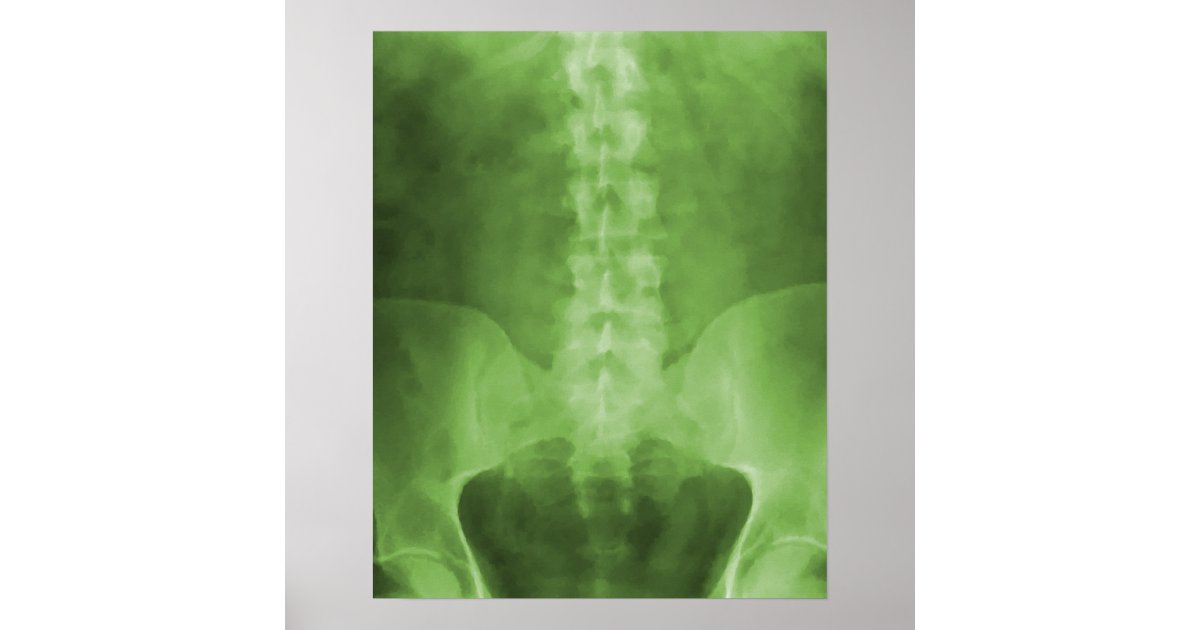 Green Digital X-Ray Art Print | Zazzle