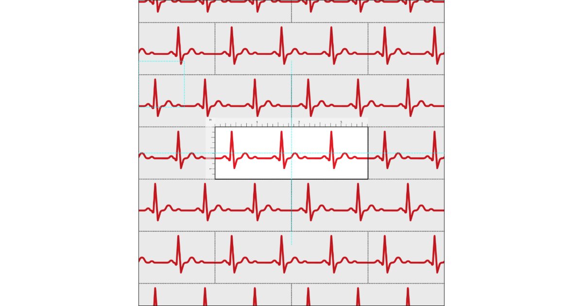 Heart Beat Rate Rhythm Medical Pattern Fabric | Zazzle