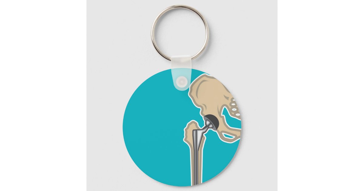 Hip Joint Replacement Keychain | Zazzle