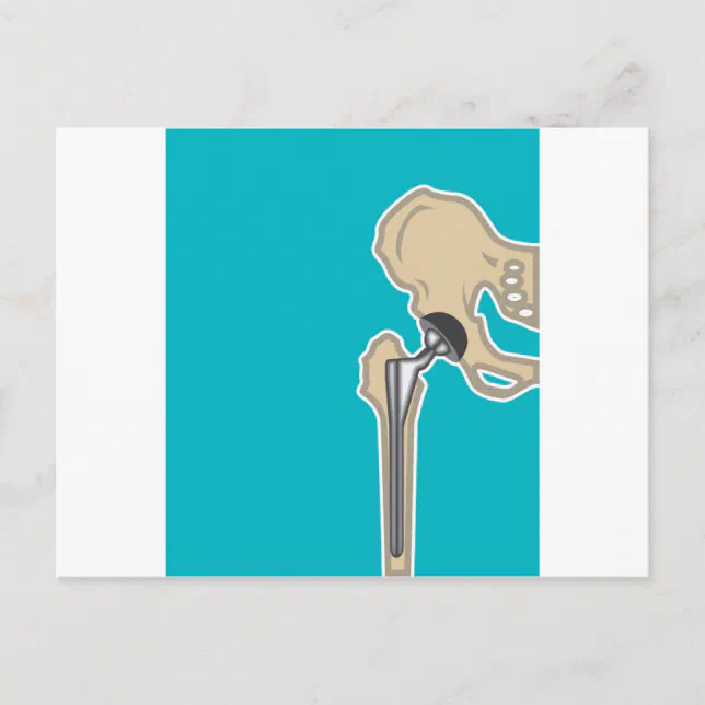 Hip Joint Replacement Postcard | Zazzle