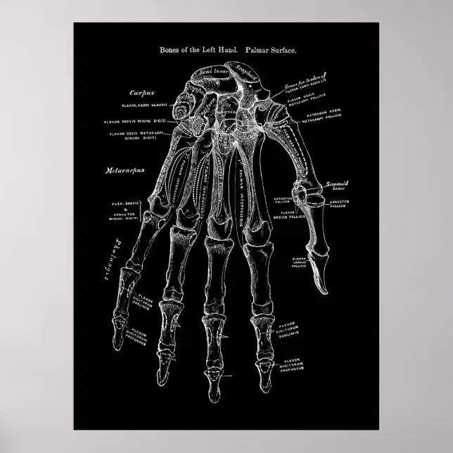Human Hand Bone Anatomy Art Poster | Zazzle