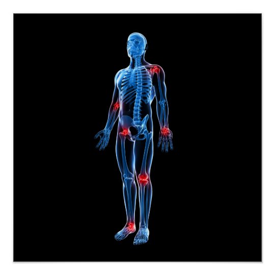 Human Xray Poster | Zazzle.com