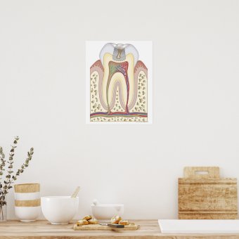 Illustration of Tooth Decay Poster | Zazzle