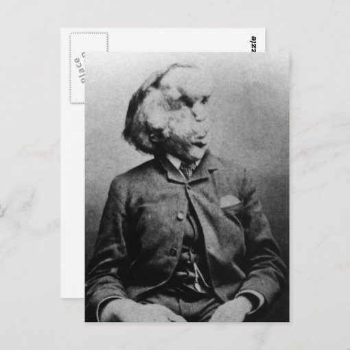 Joseph "John" Merrick The Elephant Man from 1889 Postcard | Zazzle