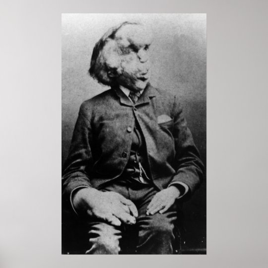 Joseph "John" Merrick The Elephant Man from 1889 Poster | Zazzle.com