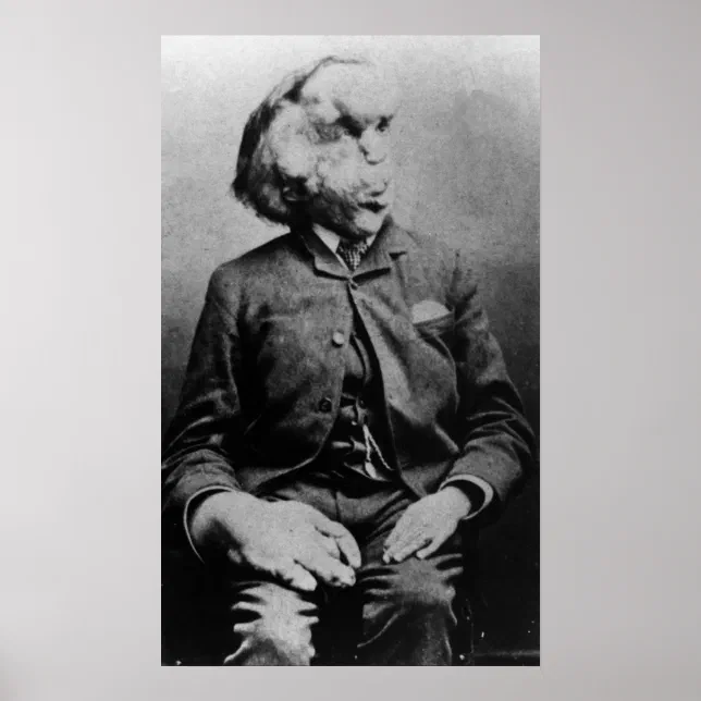 Joseph "John" Merrick The Elephant Man from 1889 Poster | Zazzle
