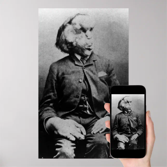 Joseph "John" Merrick The Elephant Man from 1889 Poster | Zazzle