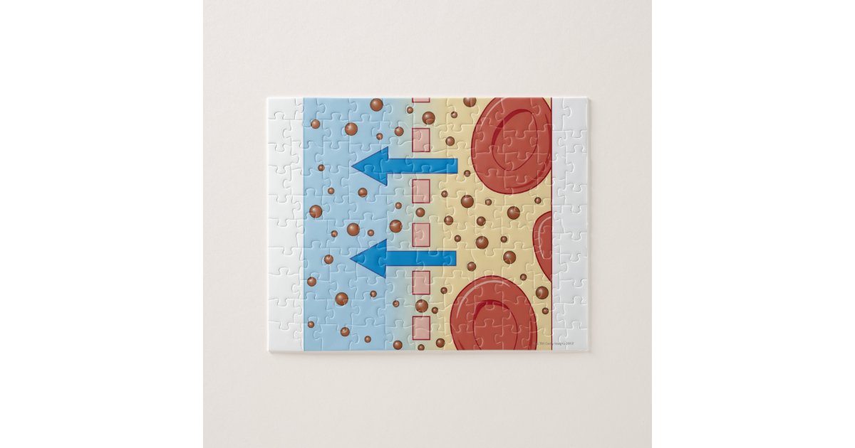 Kidney Dialysis Jigsaw Puzzle | Zazzle