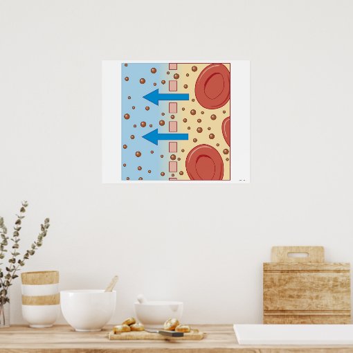 Kidney Dialysis Poster | Zazzle