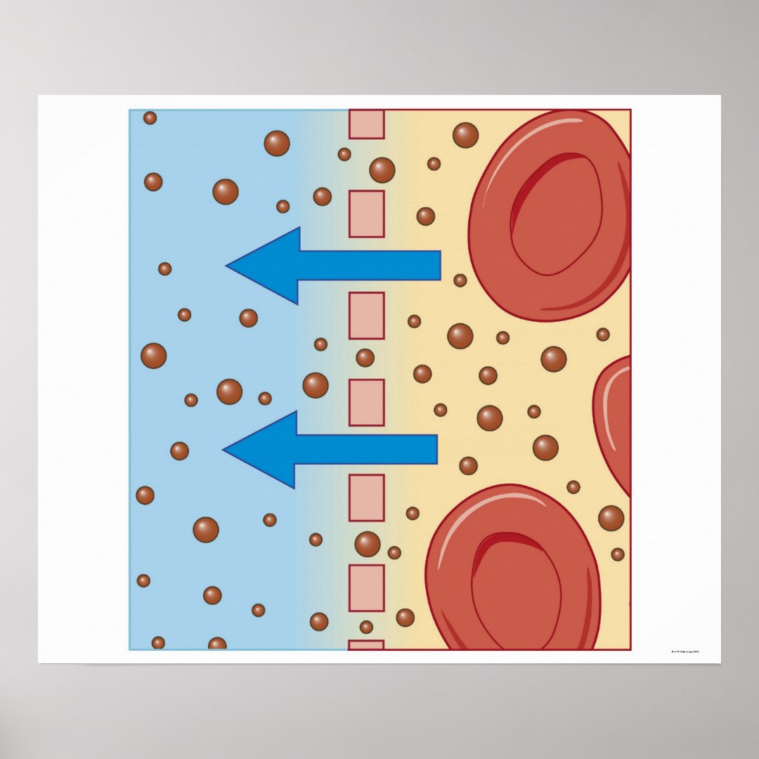 Kidney Dialysis Poster | Zazzle
