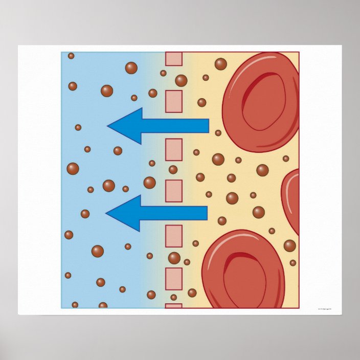 Kidney Dialysis Poster | Zazzle.com