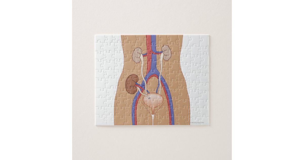 Kidney Transplant Jigsaw Puzzle | Zazzle