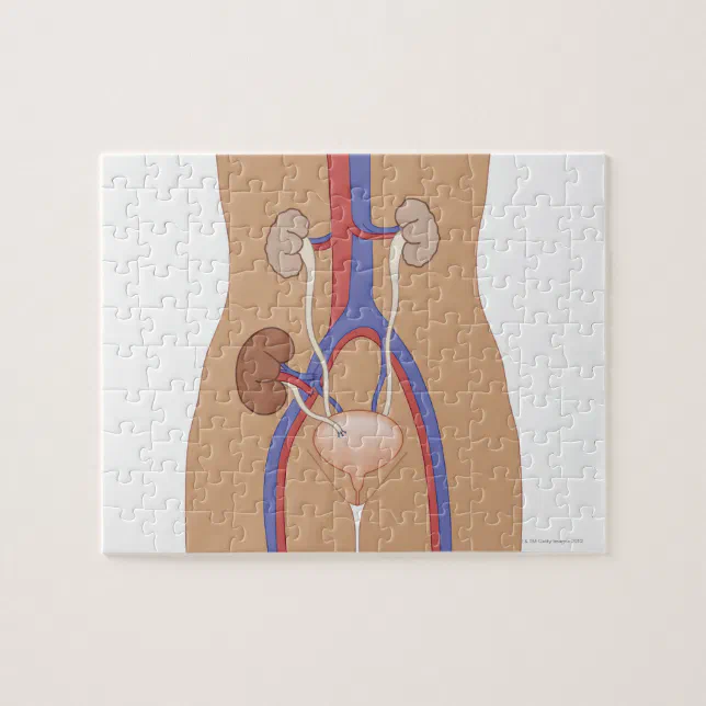 Kidney Transplant Jigsaw Puzzle | Zazzle