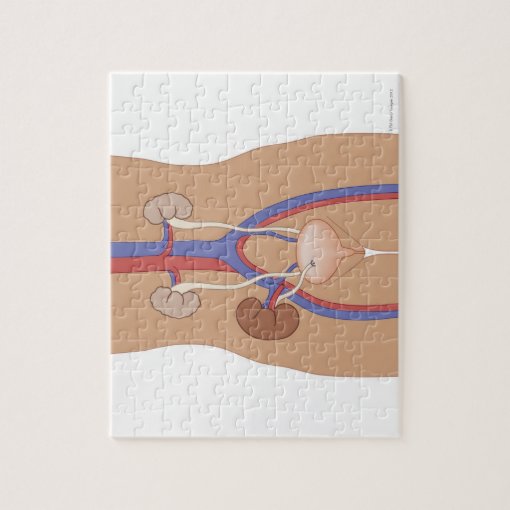Kidney Transplant Jigsaw Puzzle | Zazzle