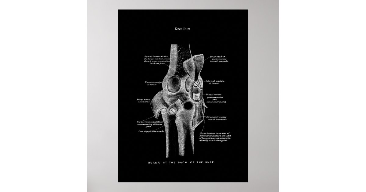 Knee Joints Anatomy Art Poster | Zazzle