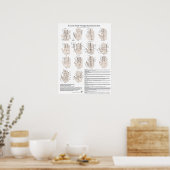 Korean Hand Acupuncture Meridian System Poster | Zazzle