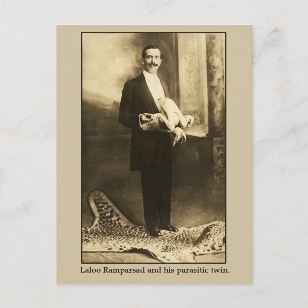 Laloo, the Happy Hindoo with a Parasitic Twin Postcard | Zazzle