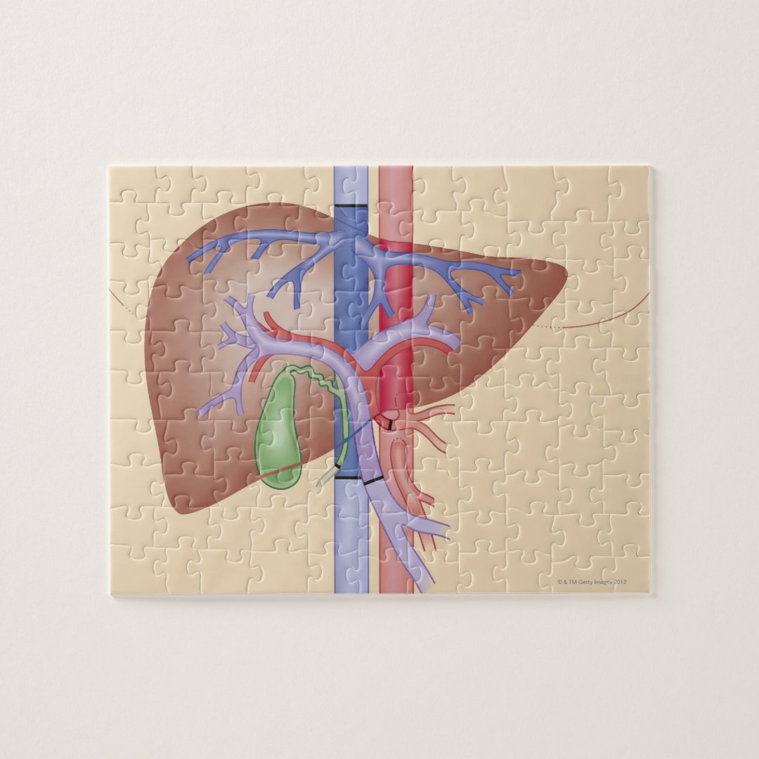 Liver Transplant Procedure Jigsaw Puzzle | Zazzle