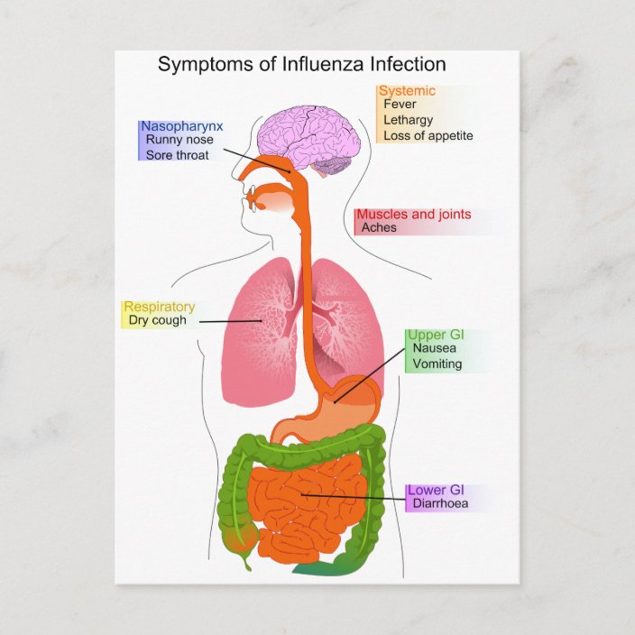 Main Symptoms of an Influenza Infection Diagram Postcard | Zazzle.com