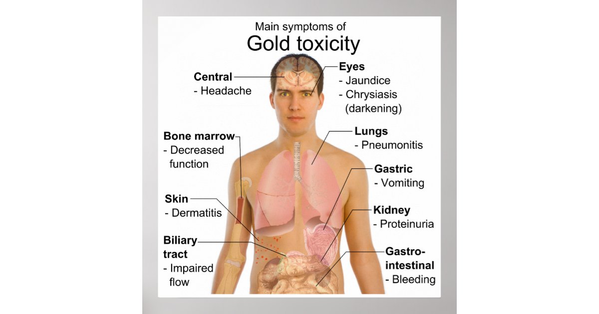 Main Symptoms of Gold Toxicity in Humans Chart | Zazzle