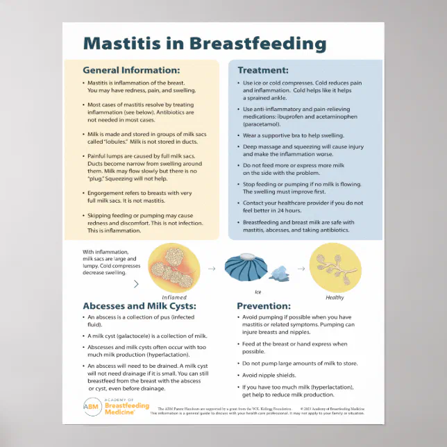 Mastitis in Breastfeeding Poster (English) | Zazzle