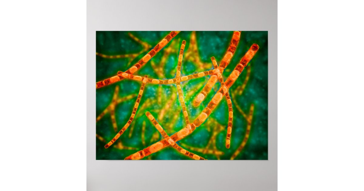 Microscopic View Of Anthrax 2 Poster | Zazzle