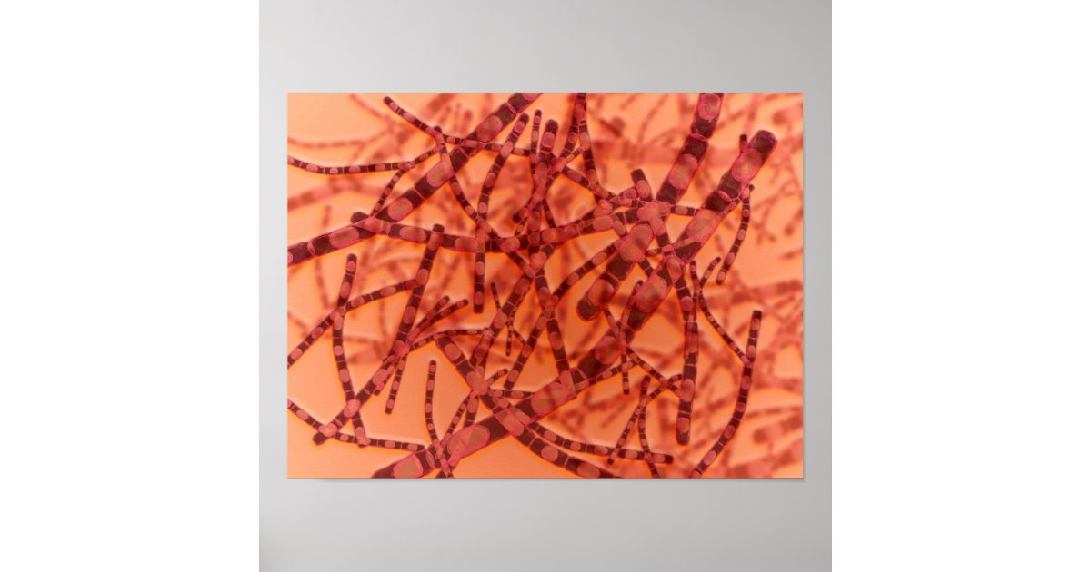 Microscopic View Of Anthrax 3 Poster | Zazzle