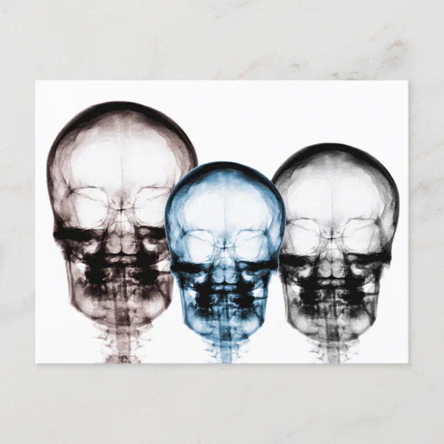 Mixed Colors X-Ray Vision Skeleton Skulls Postcard | Zazzle
