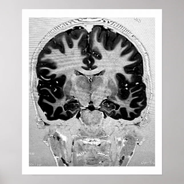 MRI Head Poster | Zazzle