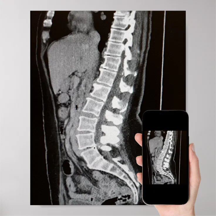 MRI of the Spine Poster | Zazzle