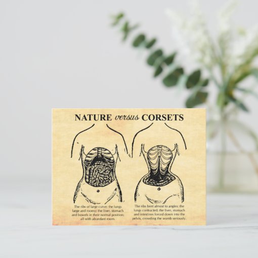 Nature versus Corsets Postcard | Zazzle