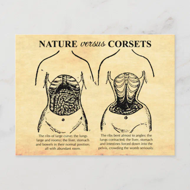 Nature versus Corsets Postcard | Zazzle