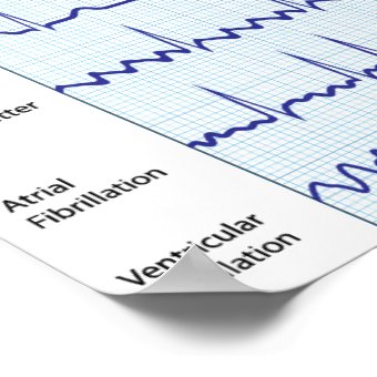 Normal and pathological ecg Poster | Zazzle