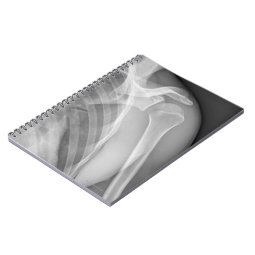 Normal shoulder. X-ray of the healthy left Notebook | Zazzle
