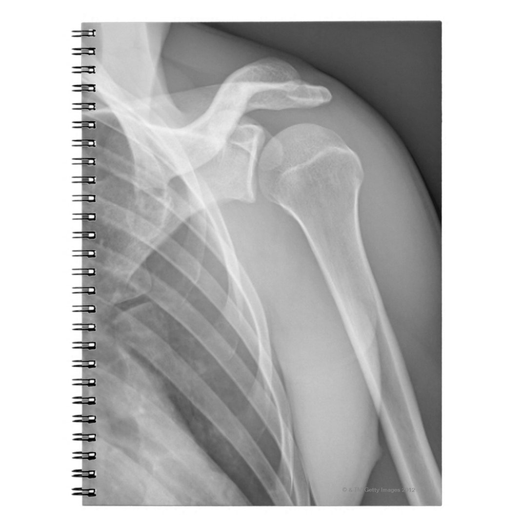 Normal shoulder. X-ray of the healthy left Notebook | Zazzle