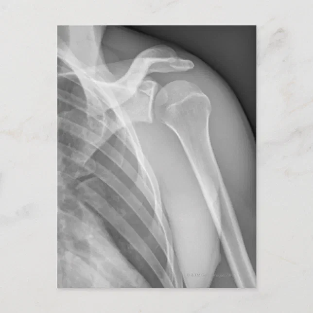 Normal shoulder. X-ray of the healthy left Postcard | Zazzle