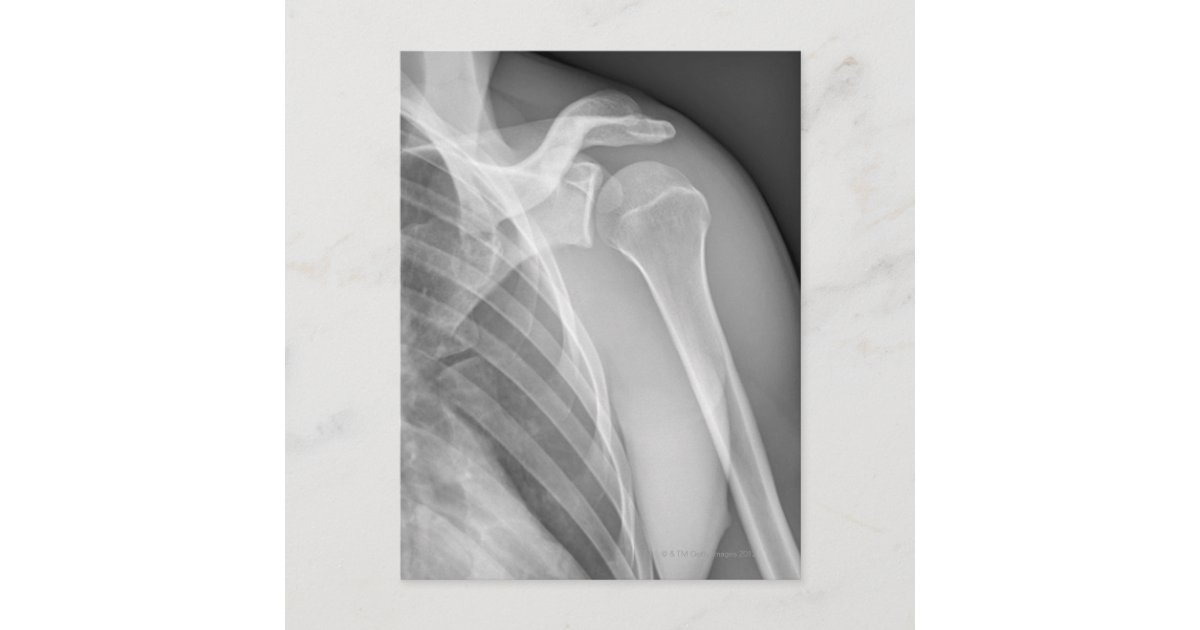 Normal shoulder. X-ray of the healthy left Postcard | Zazzle