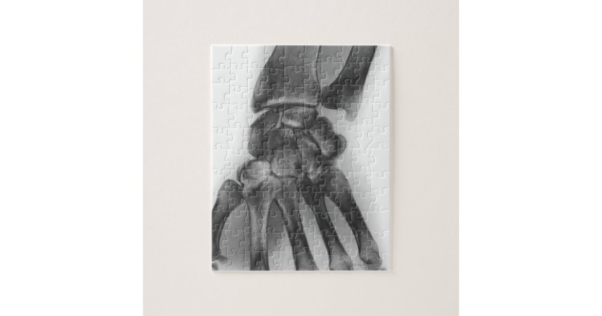 Normal wrist, X-ray Jigsaw Puzzle | Zazzle