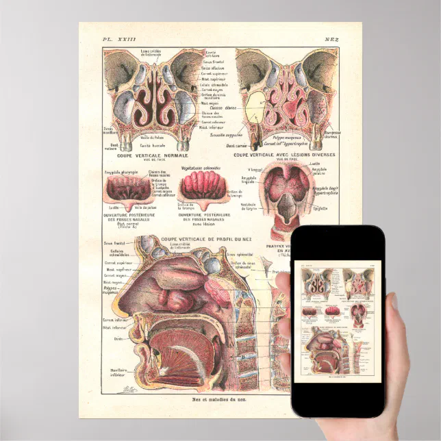 Nose & Sinuses Anatomy Poster in French | Zazzle