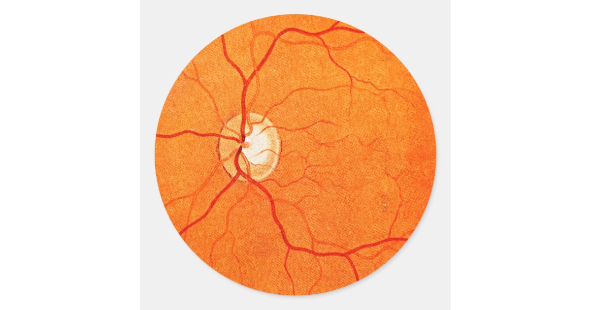 Ophthalmology Optometry Eye Fundus Exam Sticker | Zazzle