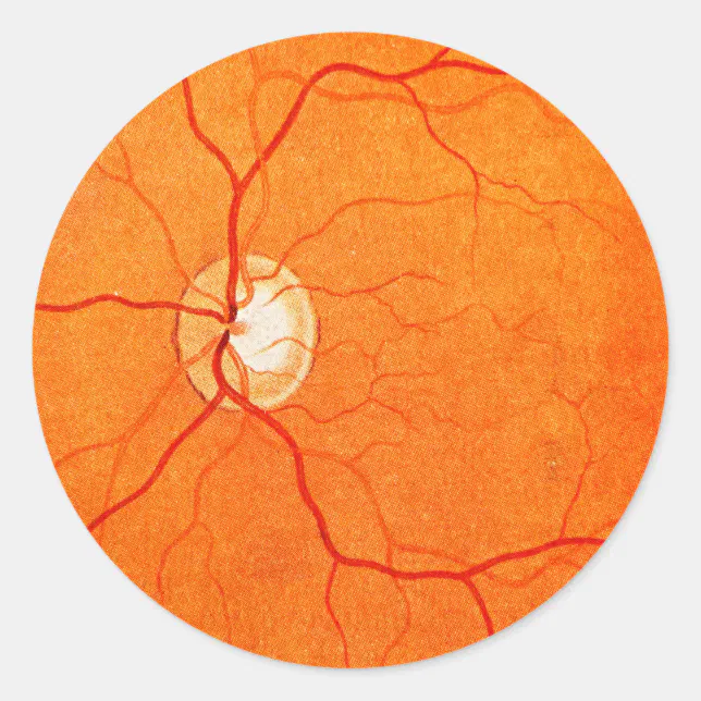 Ophthalmology Optometry Eye Fundus Exam Sticker | Zazzle