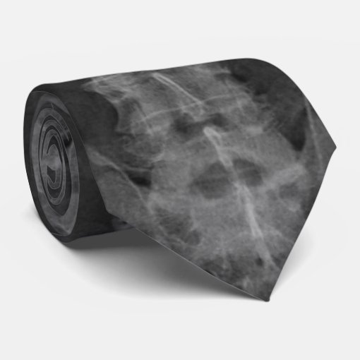 OPUS Human Spine X-Ray Tie | Zazzle
