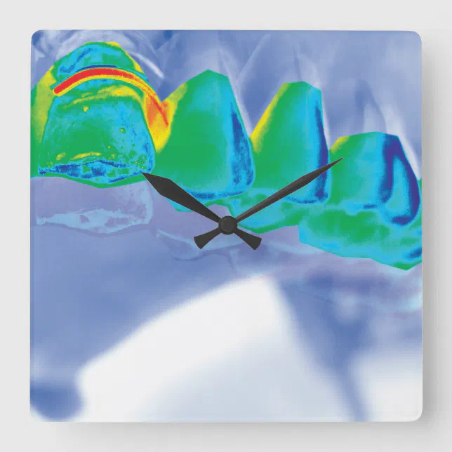 Original Teeth Design Dentist Wall Clock | Zazzle