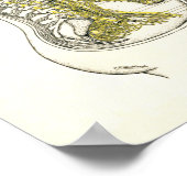 Osteopathic Sympathetic Chain Nerve Poster | Zazzle